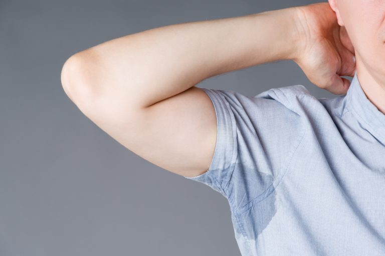 How To Treat Axillary Hyperhidrosis Excess Sweating Skin To Love