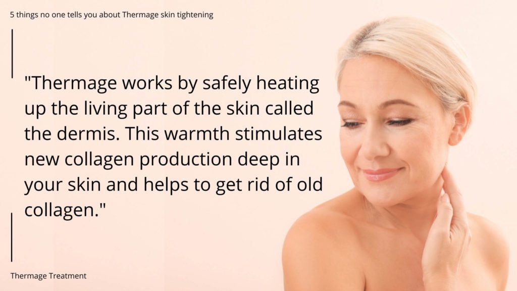5 Thermage FLX Skin Tightening Secrets For Loose Skin | Skin To Love