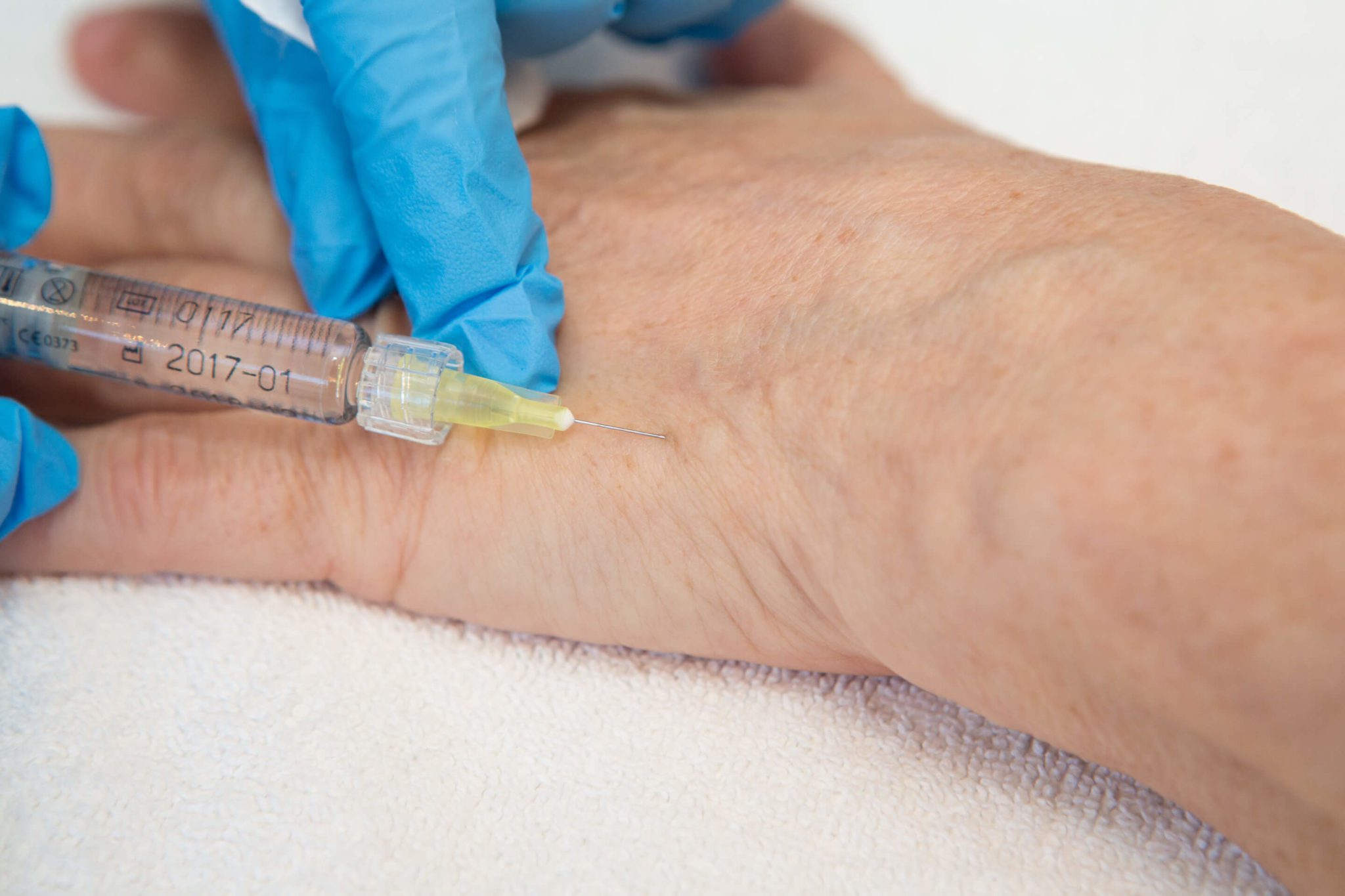 Mesotherapy Treatment | Anti-Ageing Face & Body | Skin to Love Clinic